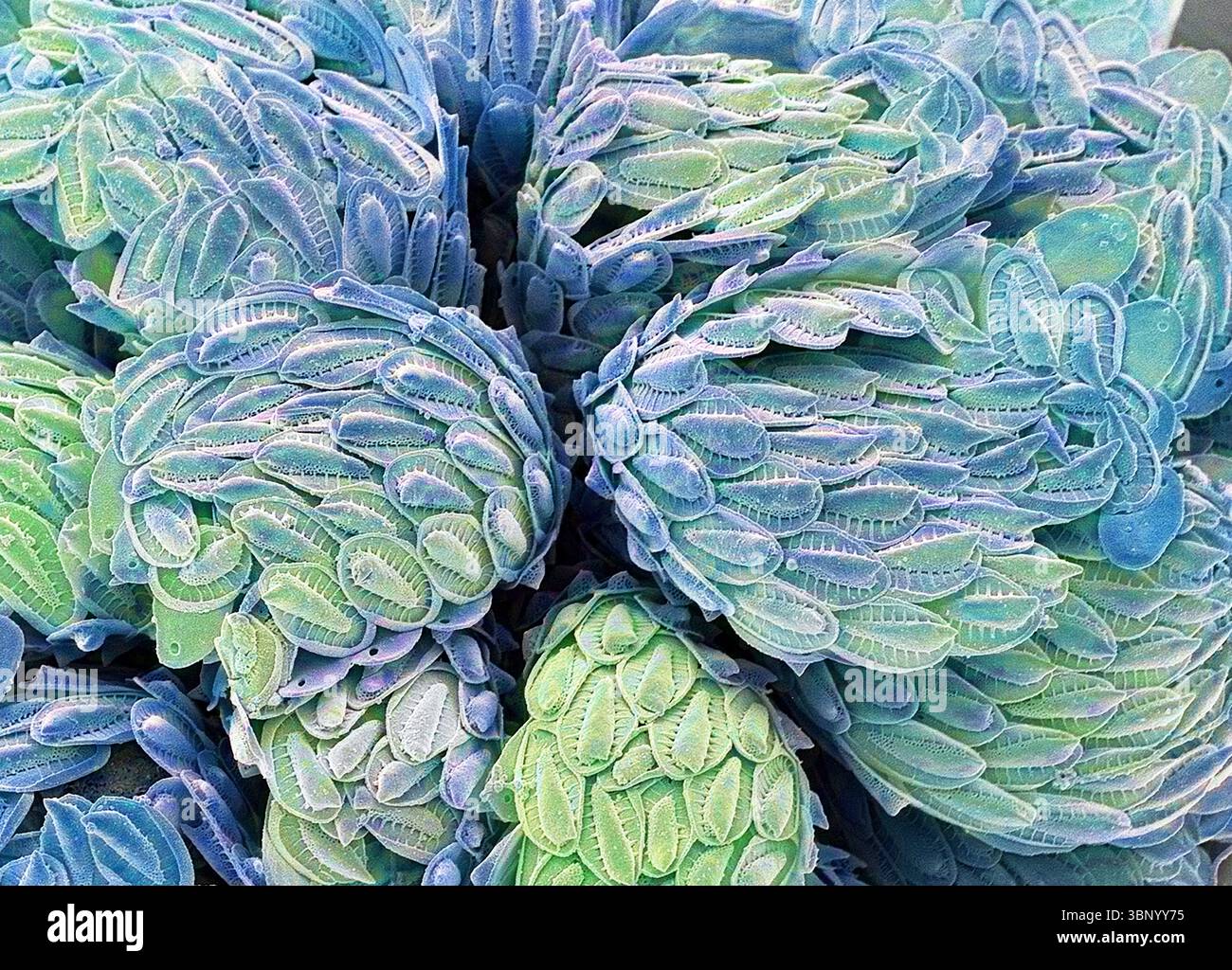 Synura golden-brown alga. Scanning electron micrograph of a colony ...