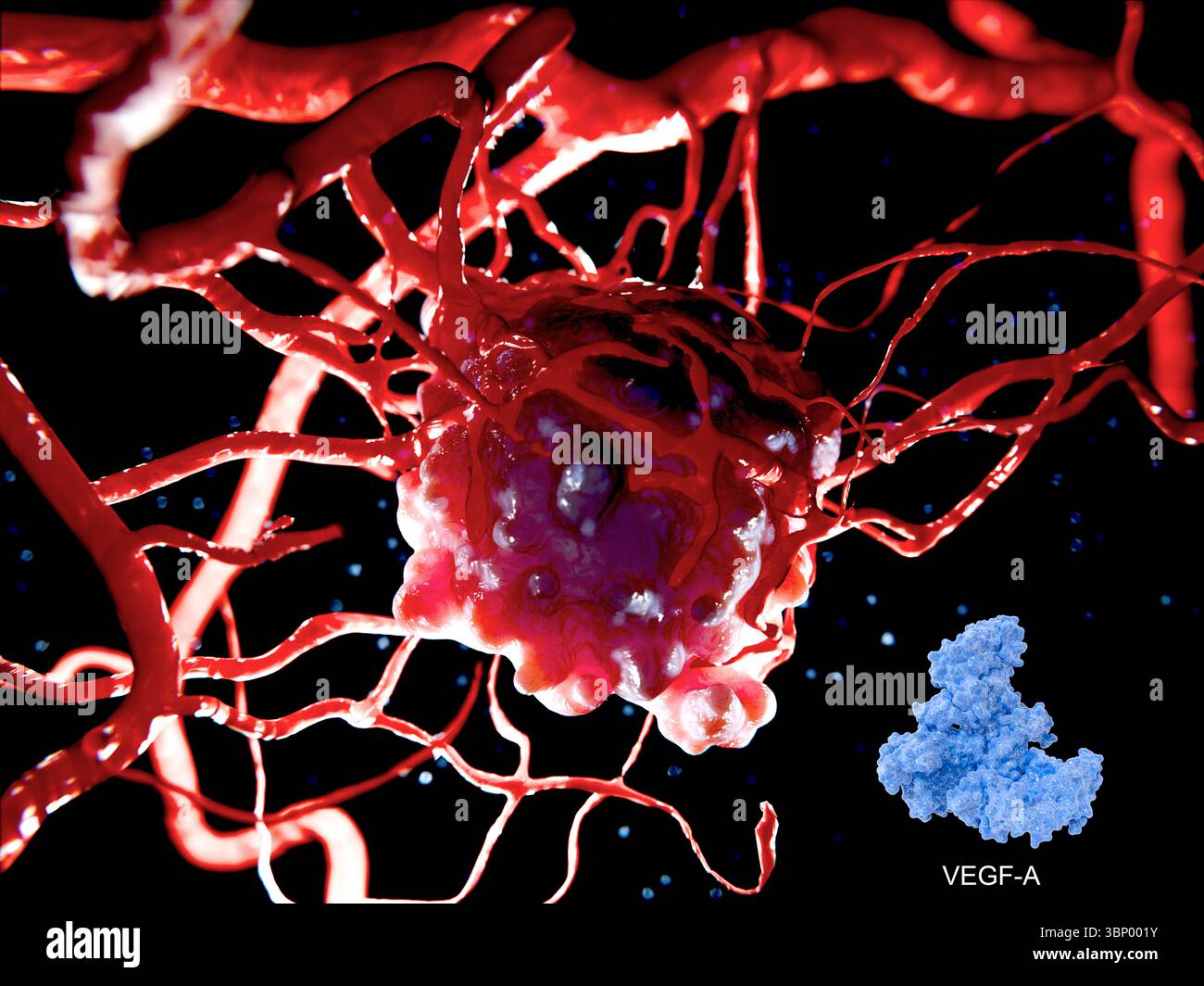 Blood vessel formation in a tumour. Illustration showing a malignant ...