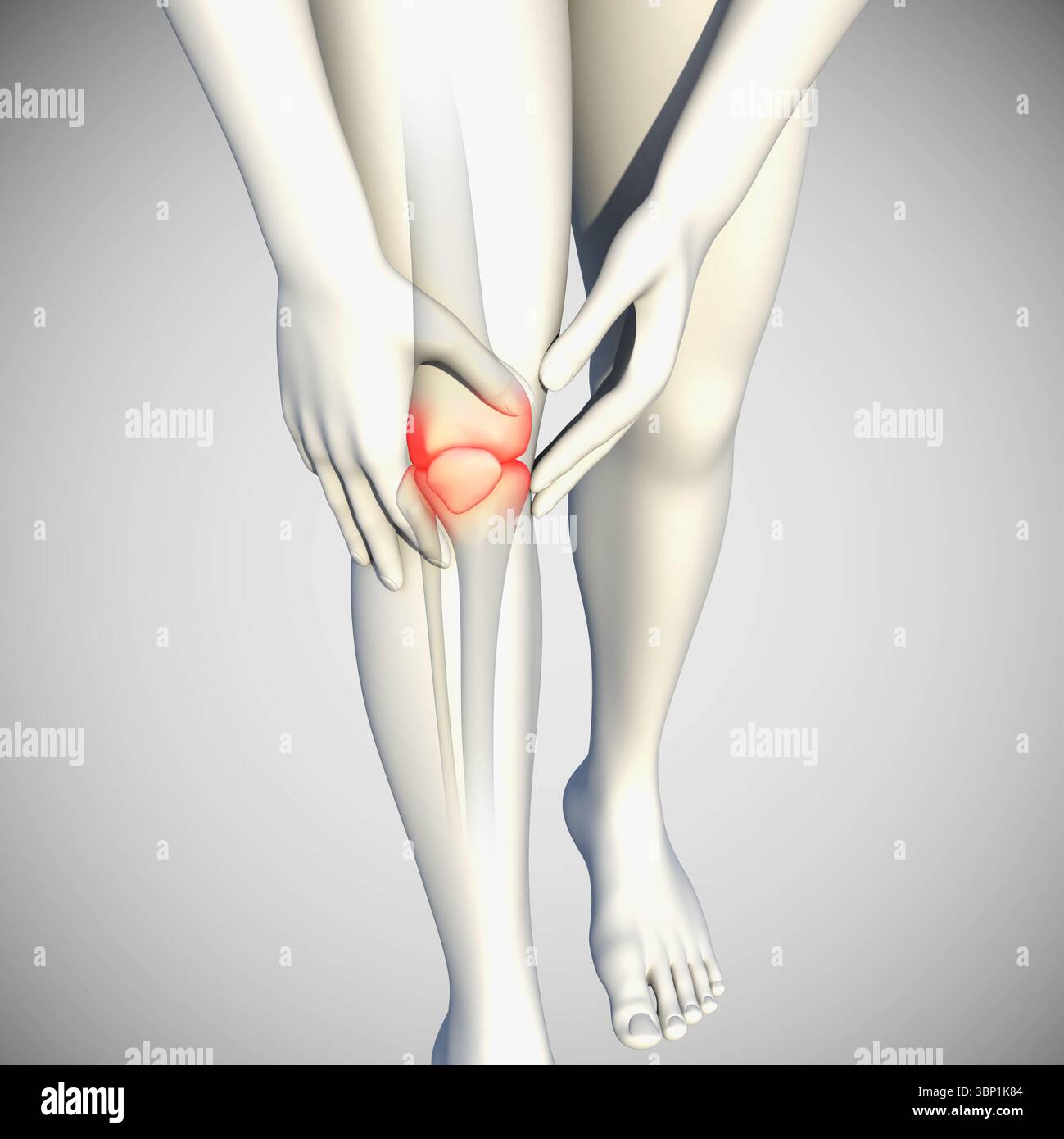 This 3d illustration shows the knee pain condition in front view Stock ...