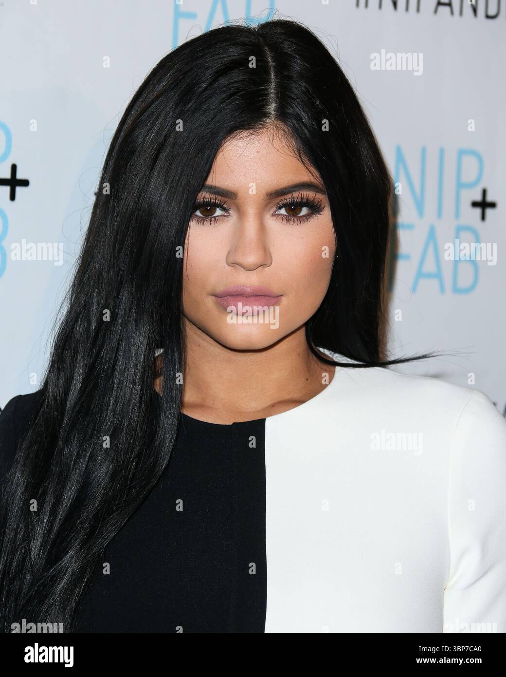 (FILE) Kylie Jenner spills plastic surgery secrets as Hollywood's ...