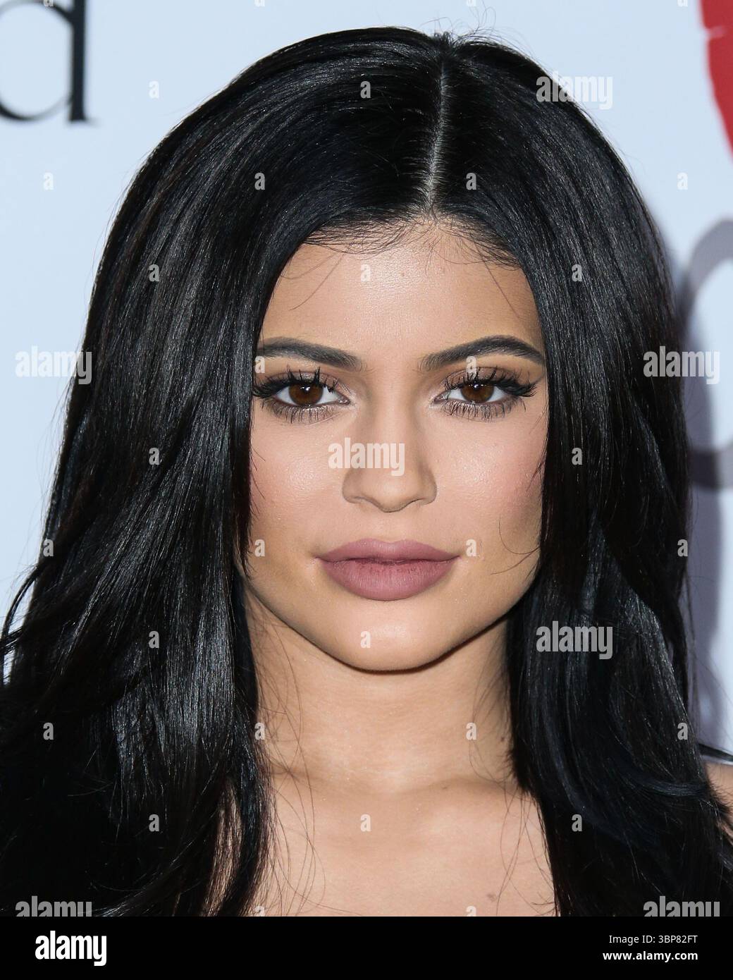 (FILE) Kylie Jenner spills plastic surgery secrets as Hollywood's ...