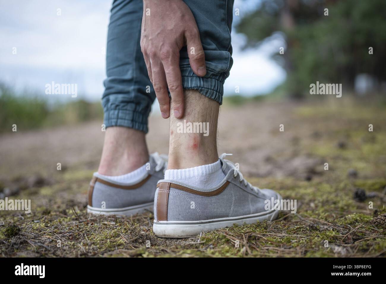 Swelling discomforted man tra hi-res stock photography and images - Alamy