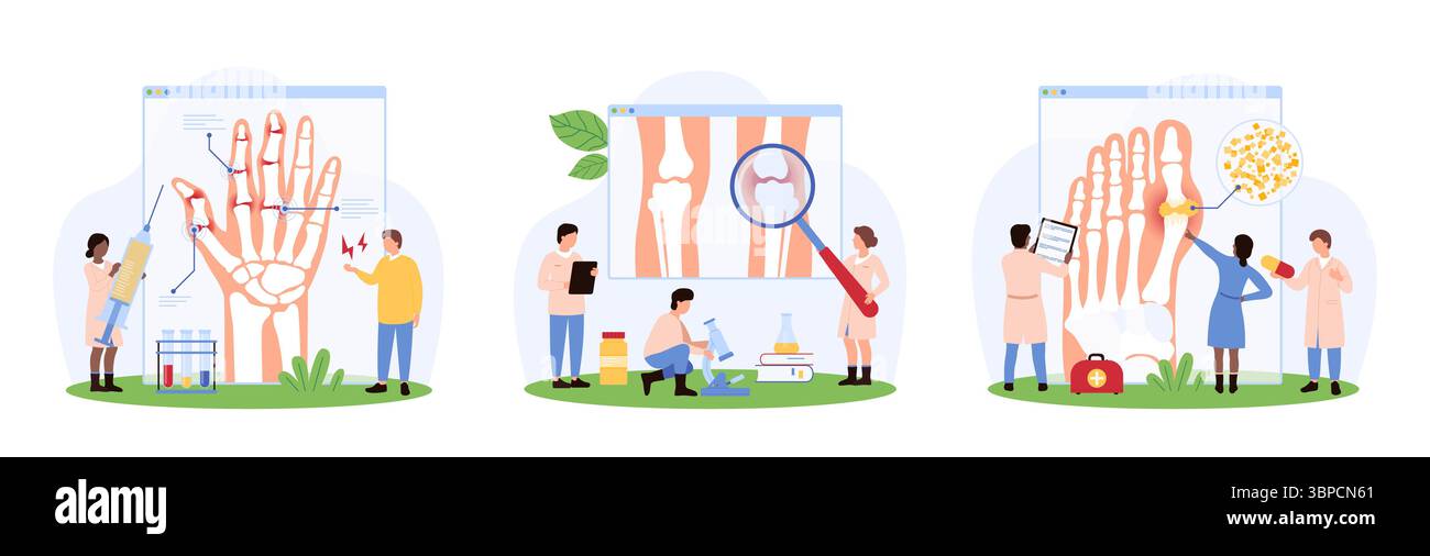 Diagnosis and treatment of osteoarthritis, rheumatoid arthritis, gout ...