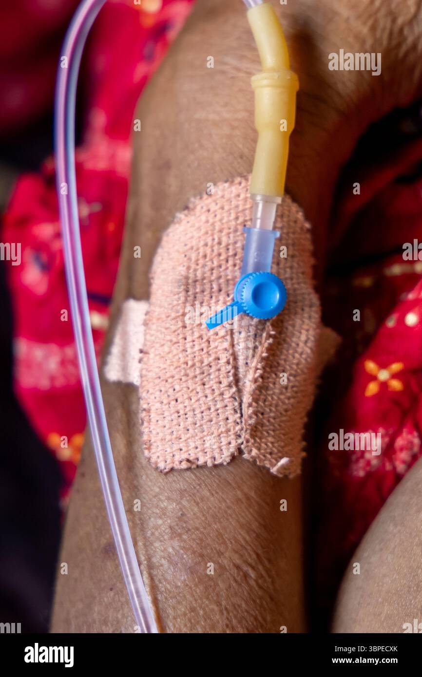 intravenous line inserted in patient hand under daylight Stock Photo ...