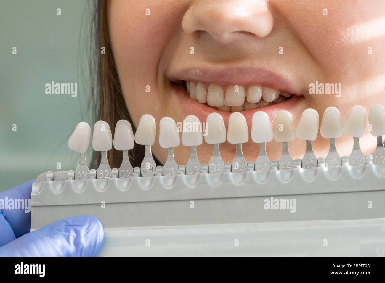 Dentist selects color palette for dental treatment smiling woman at ...