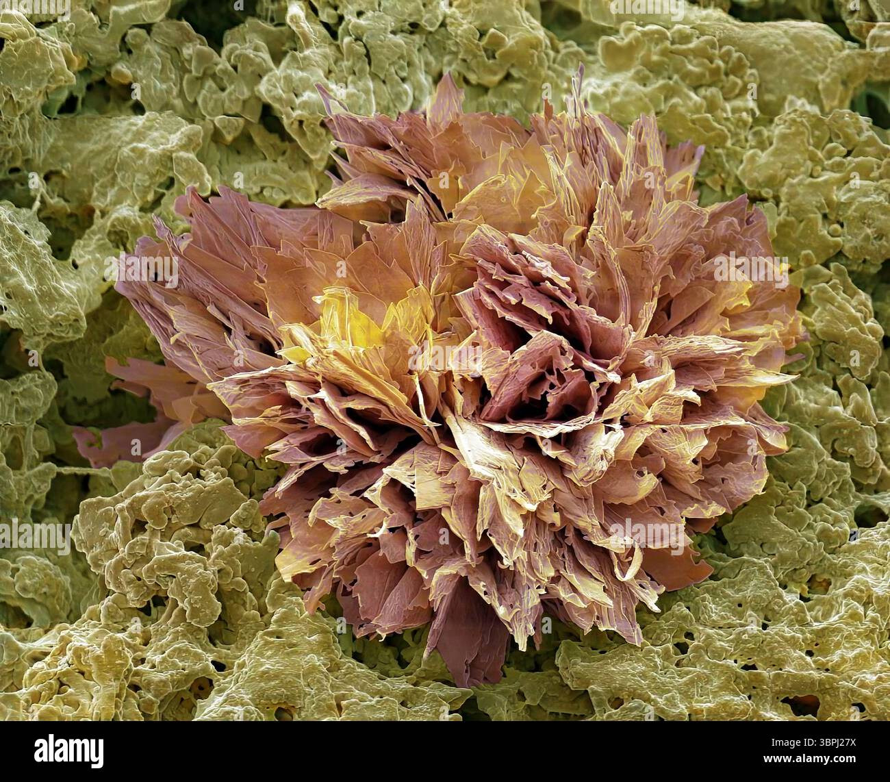 Cheese crystals. Coloured scanning electron micrograph (SEM) A variety ...