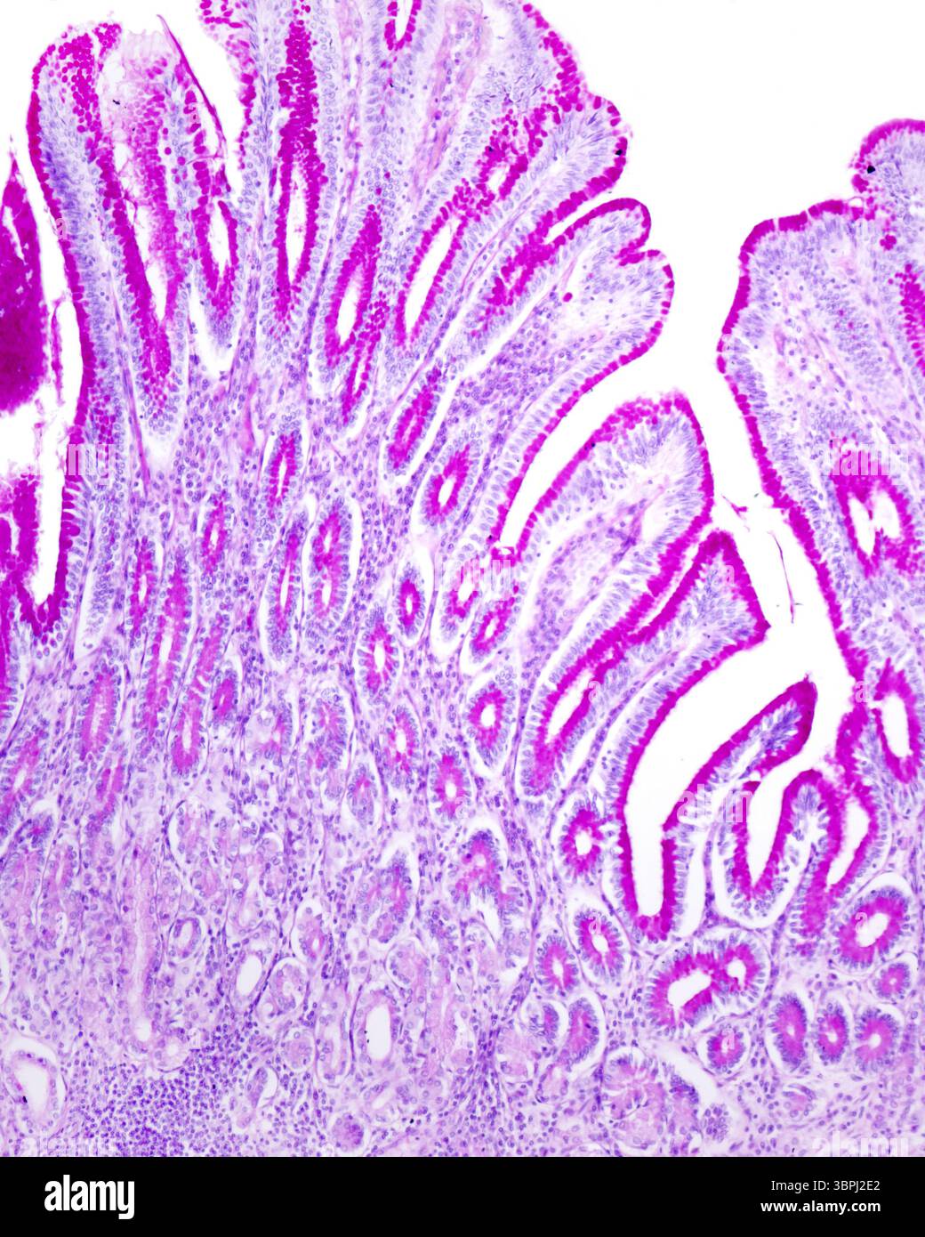 Light micrograph showing gastric pits of the pyloric antrum, where they ...