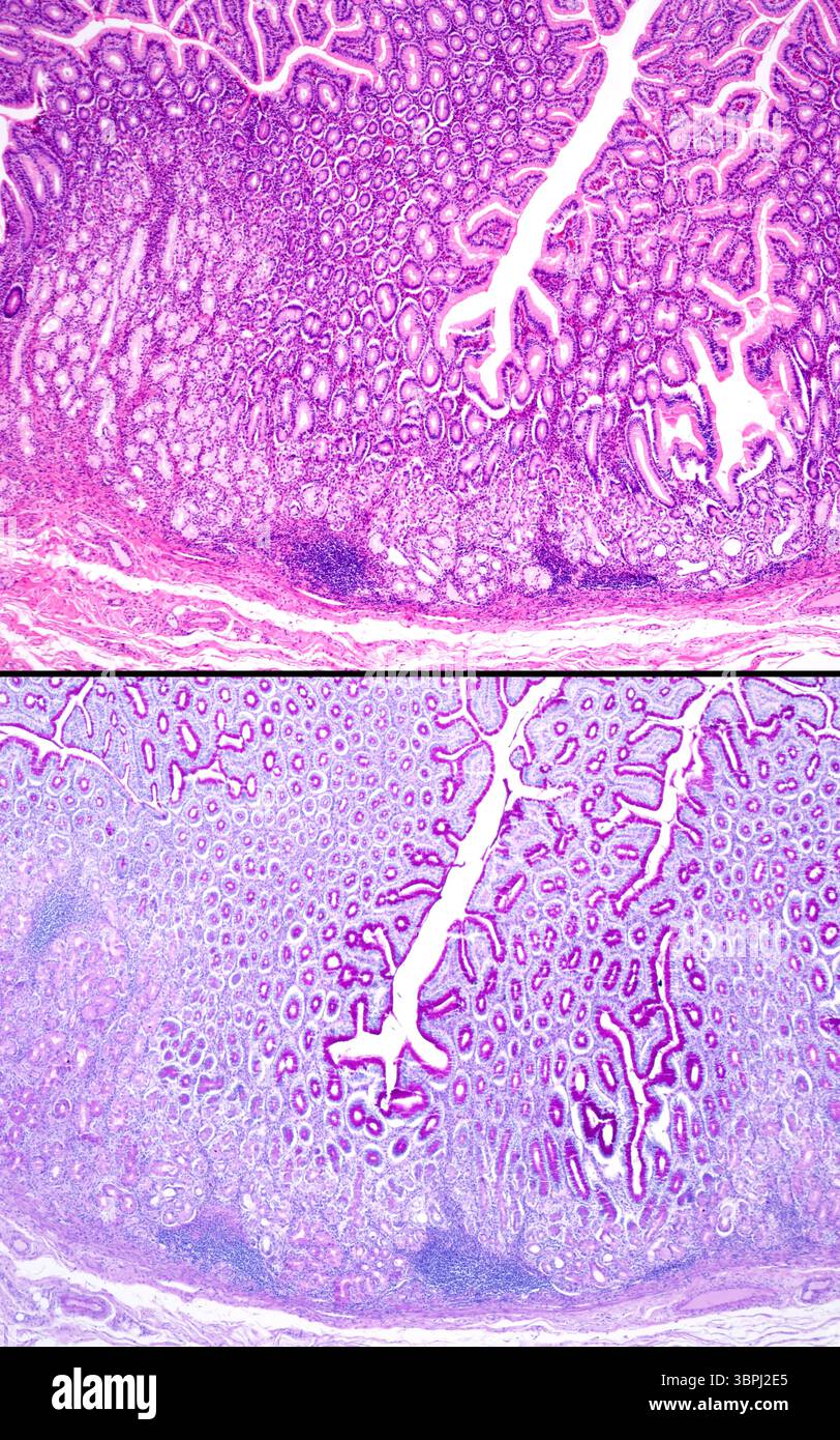 Comparative light micrographs of gastric pyloric antrum mucosa stained ...