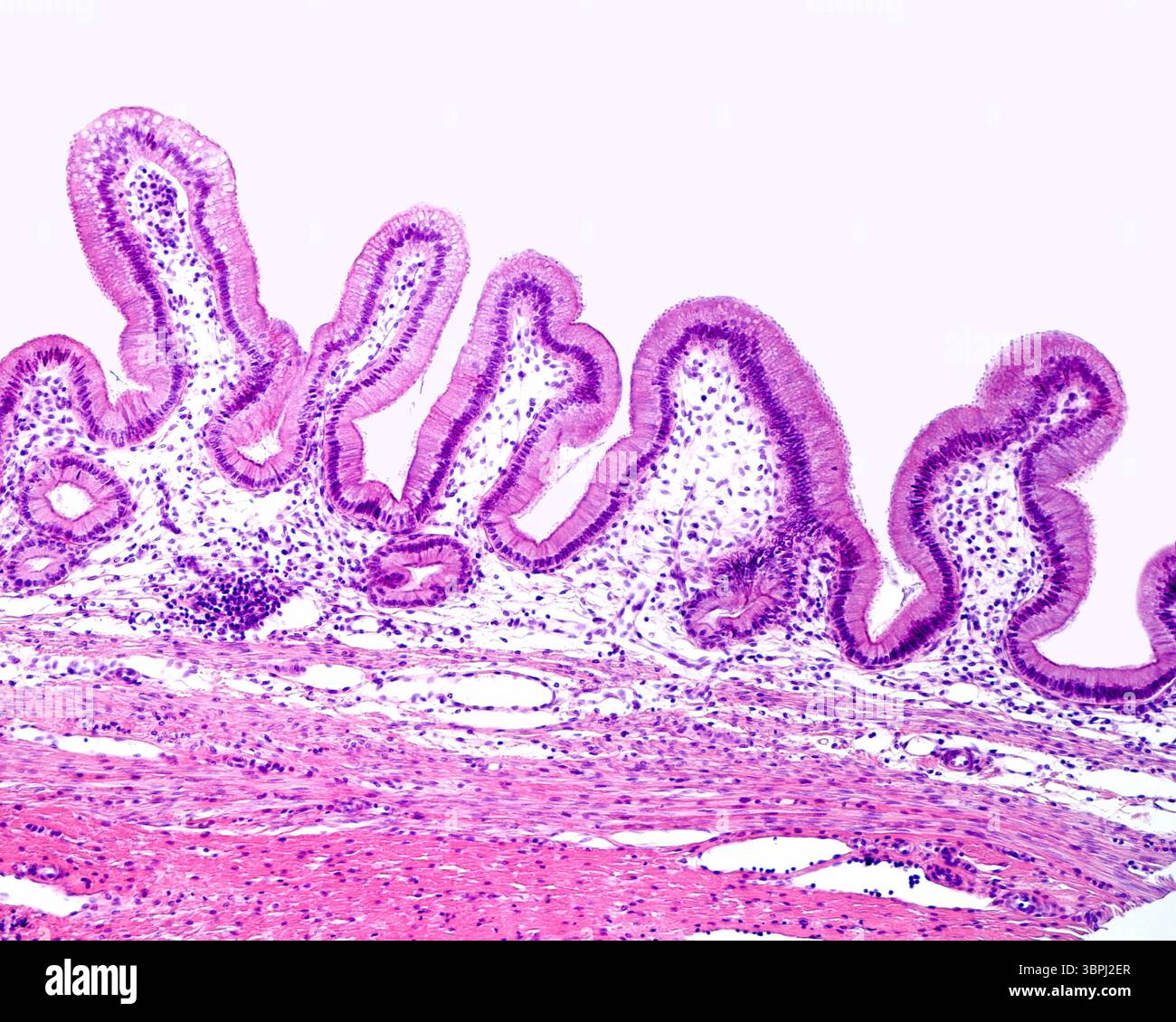 Light micrograph showing the wall of the gallbladder. At top is the ...