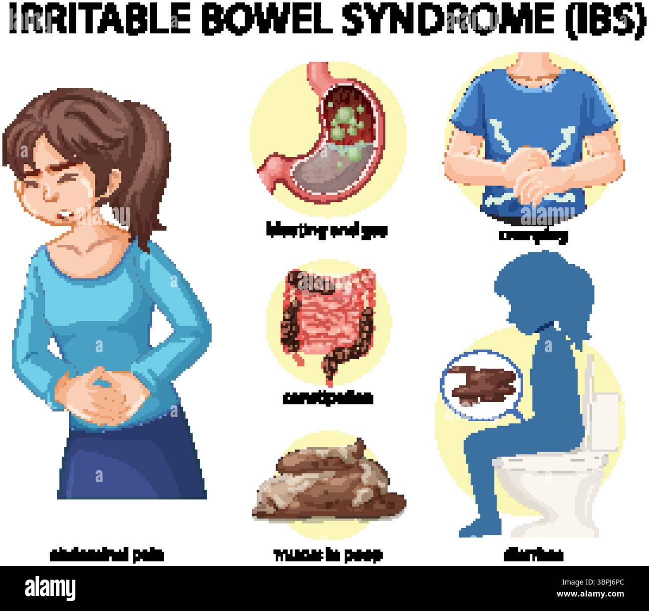 Vector illustration highlighting symptoms of IBS, including abdominal ...