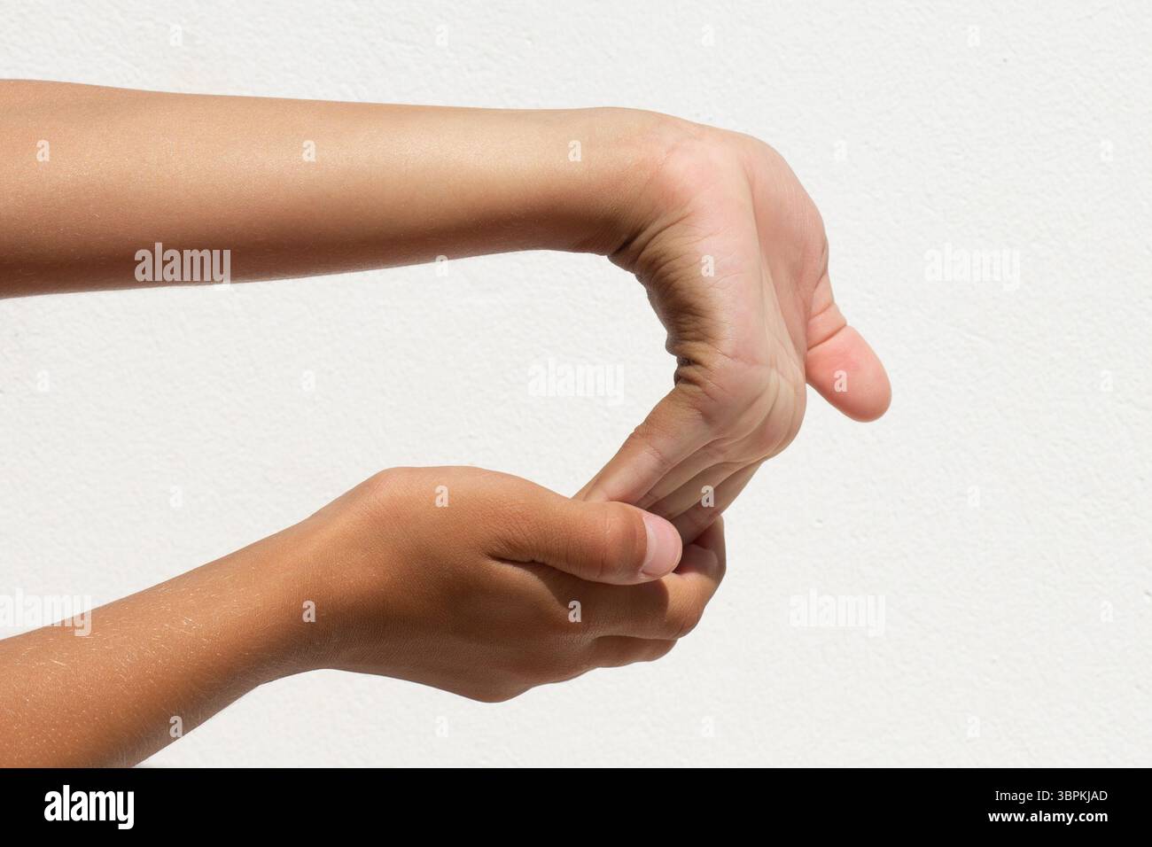 Benign joints hypermobility syndrome hi-res stock photography and ...