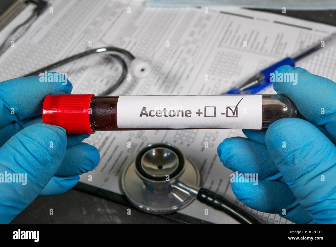 Acetone doctor holding blood sample hi-res stock photography and images ...