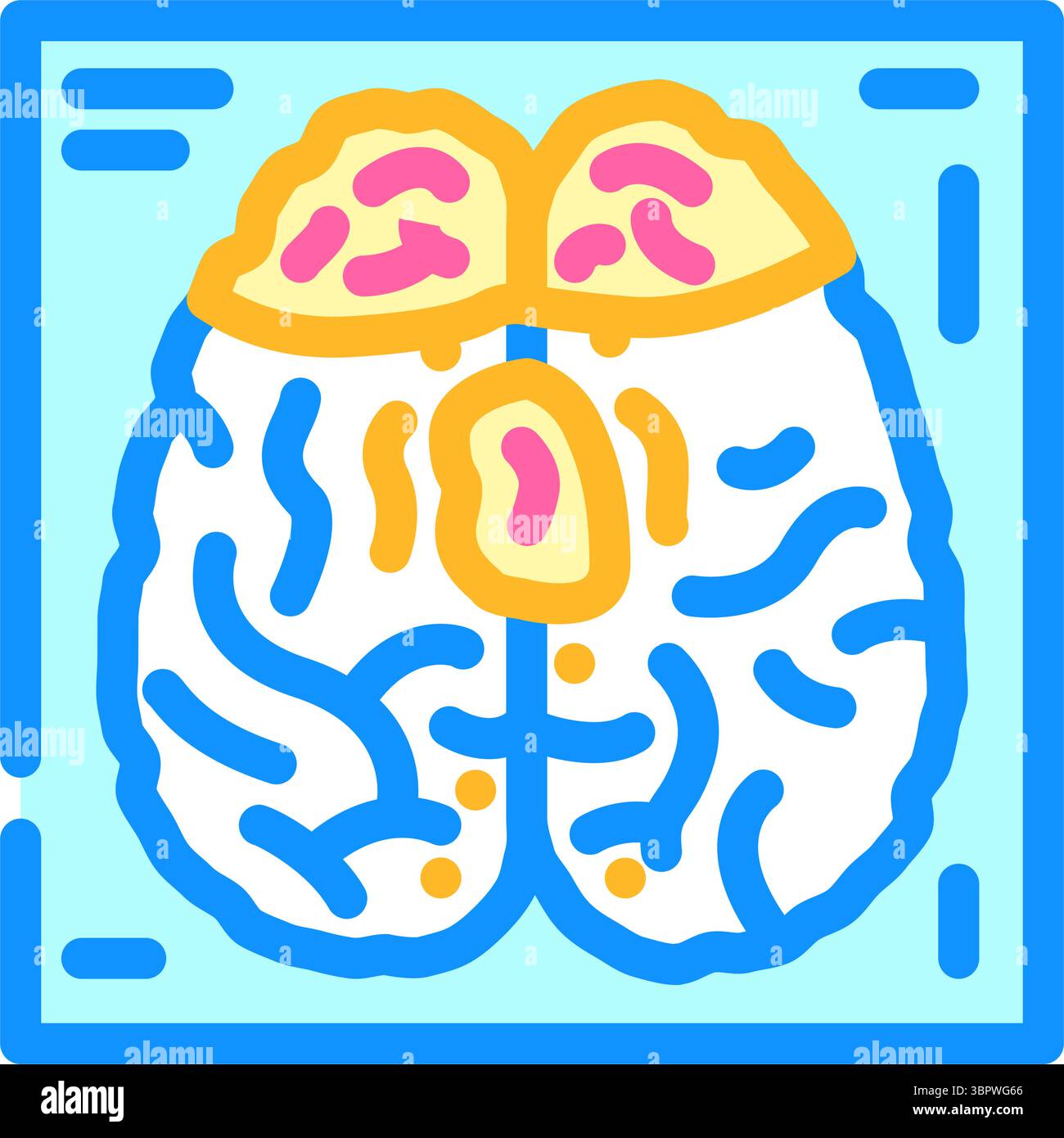 chronic traumatic encephalopathy color icon vector illustration Stock ...
