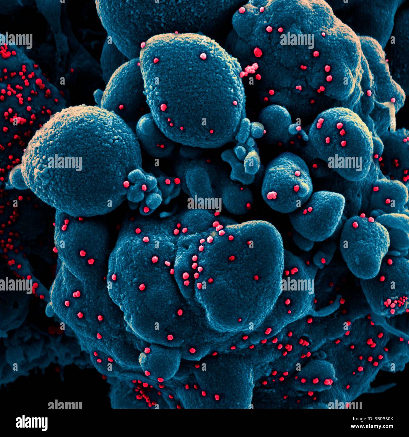 Transmission electron microscope color enhanced hi-res stock ...
