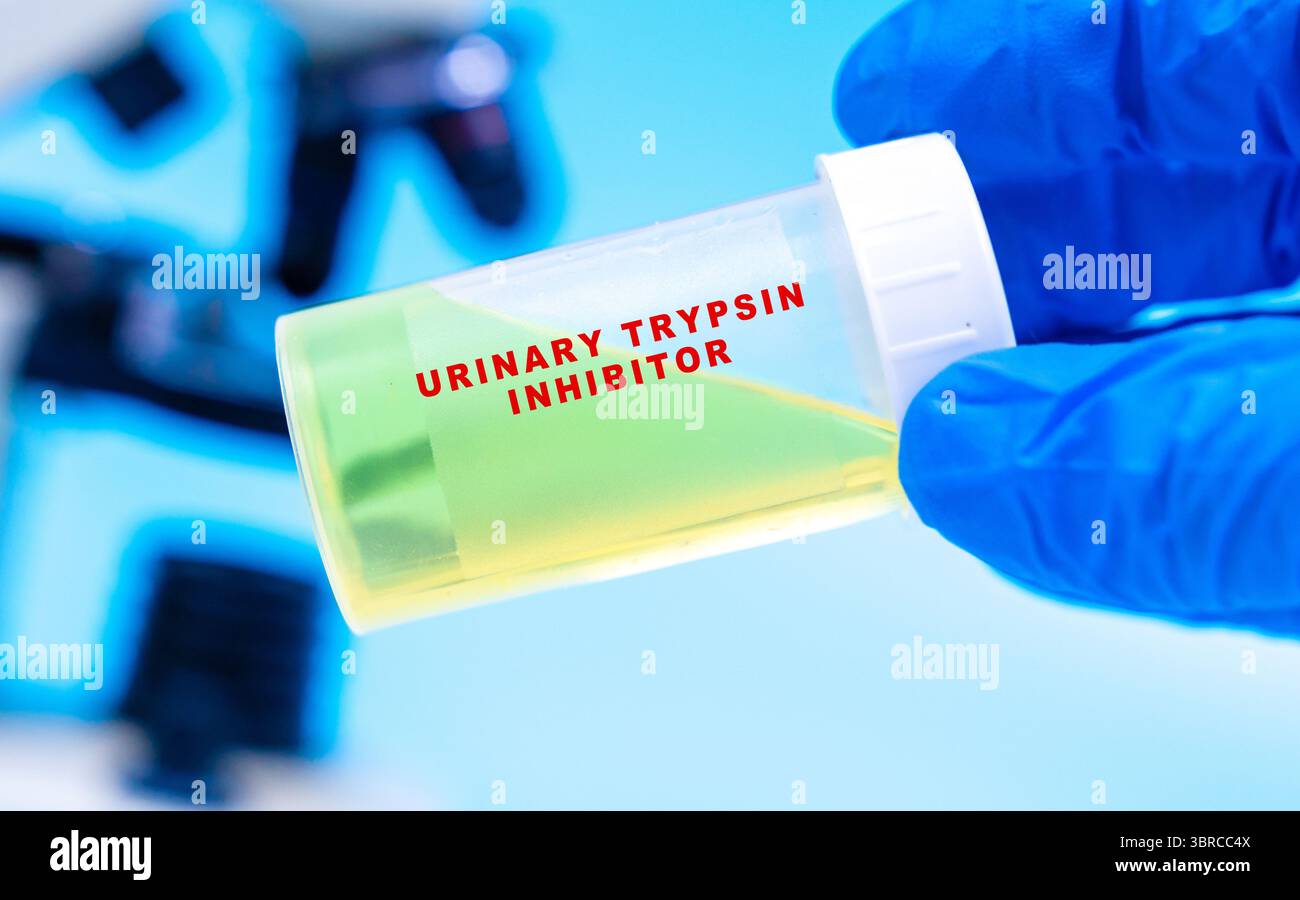 Urinary trypsin inhibitor test. Measures trypsin inhibitor levels in ...