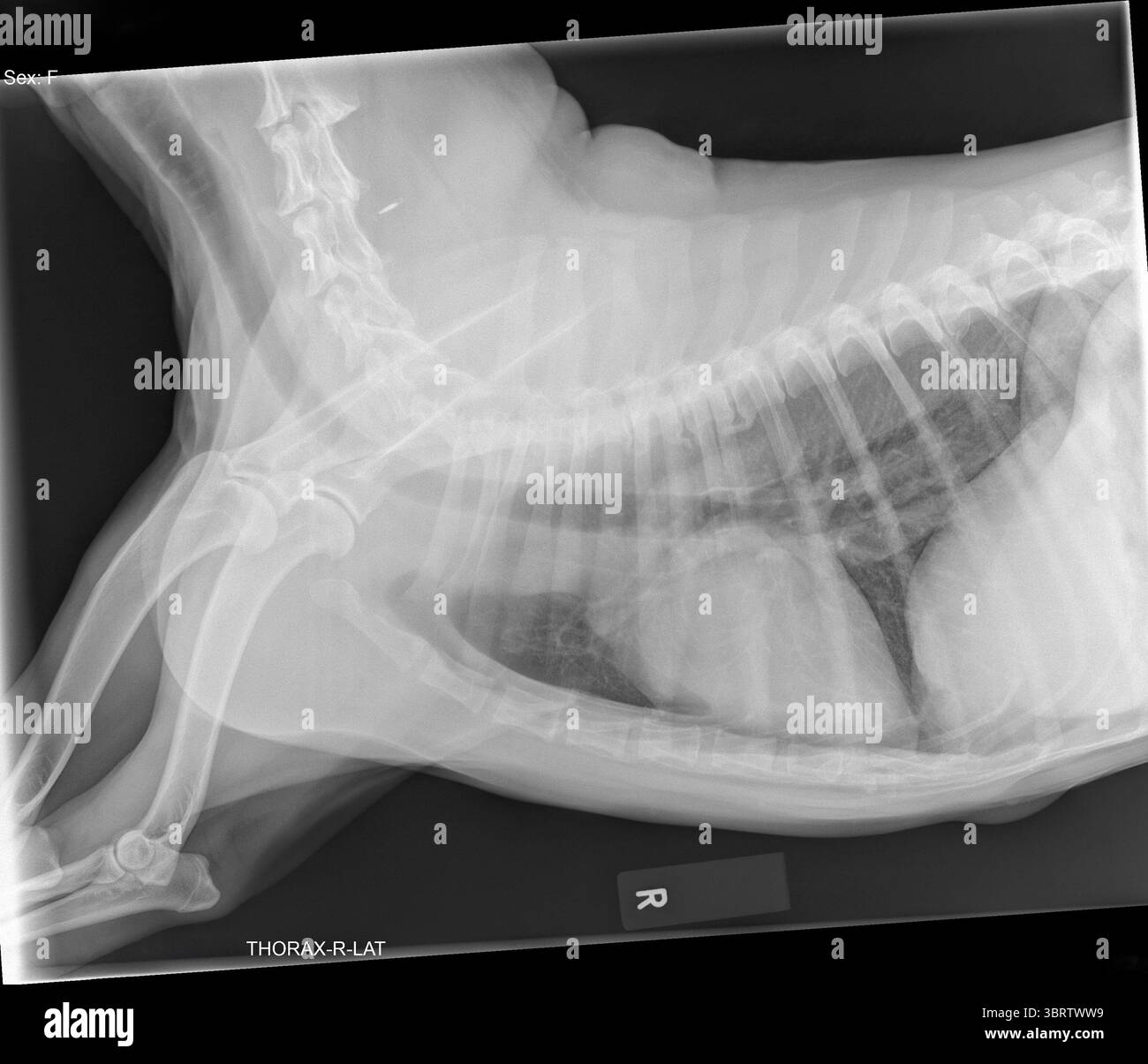 Lateral scapula x ray hi-res stock photography and images - Alamy