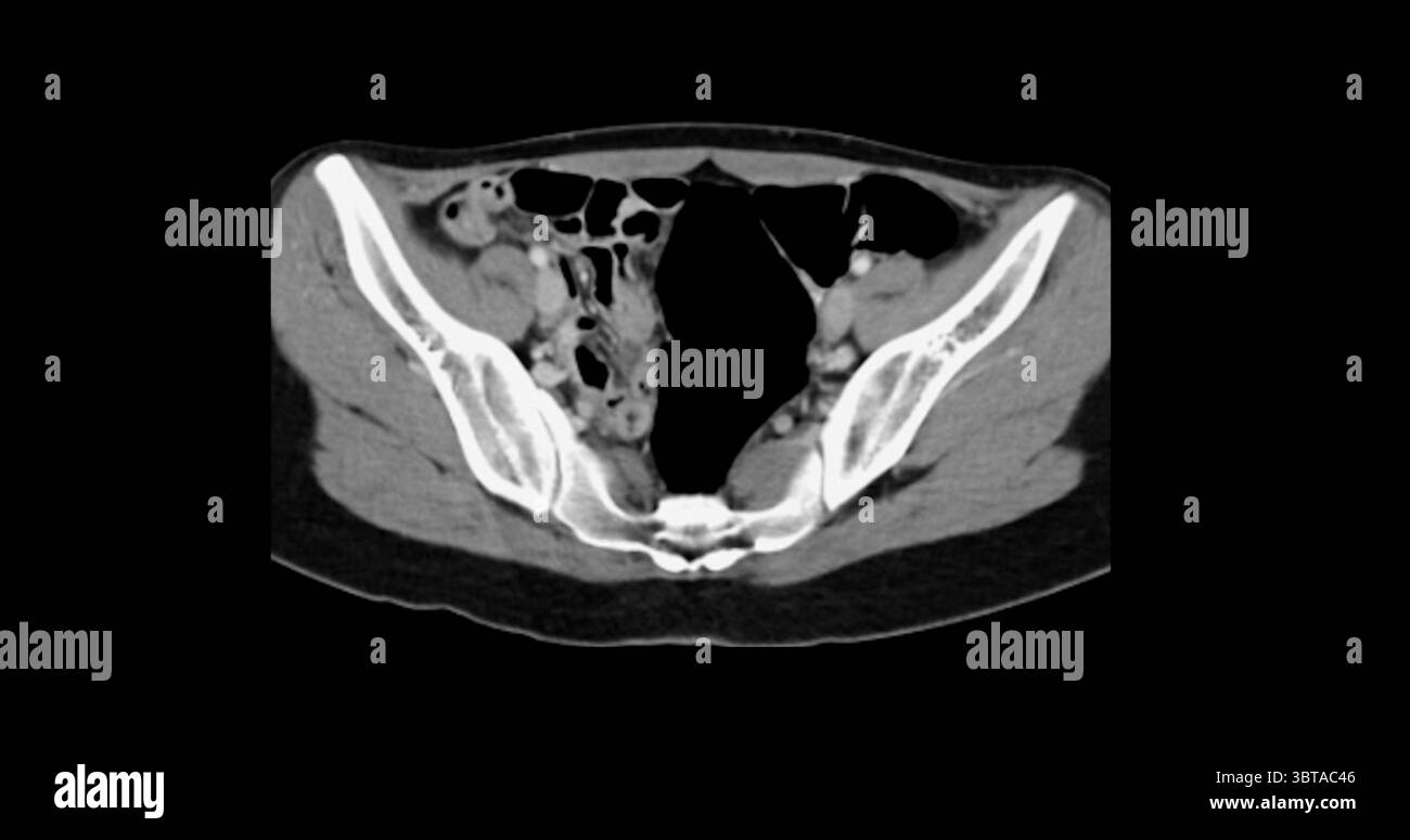 Contrast-enhanced CT whole abdomen study revealing normal anatomical ...