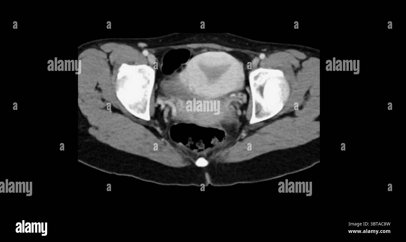 Contrast-enhanced CT whole abdomen study revealing normal anatomical ...