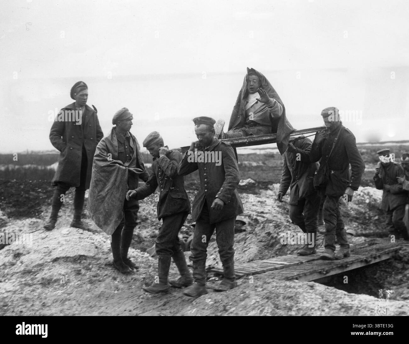 Battle of Albert . Wounded British soldier being carried from the ...