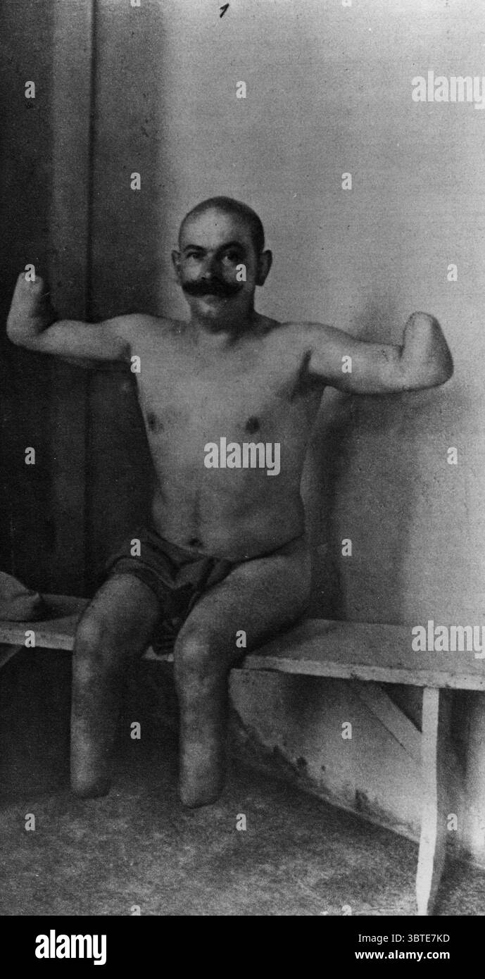 Mutilated Black and White Stock Photos & Images - Alamy