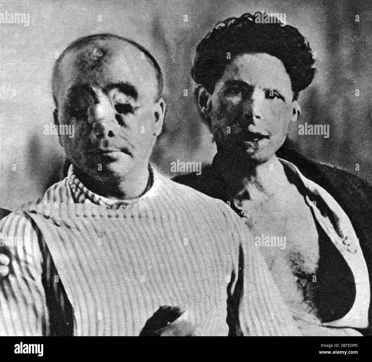 Casualties of the war , with various injuries to their face and body ...