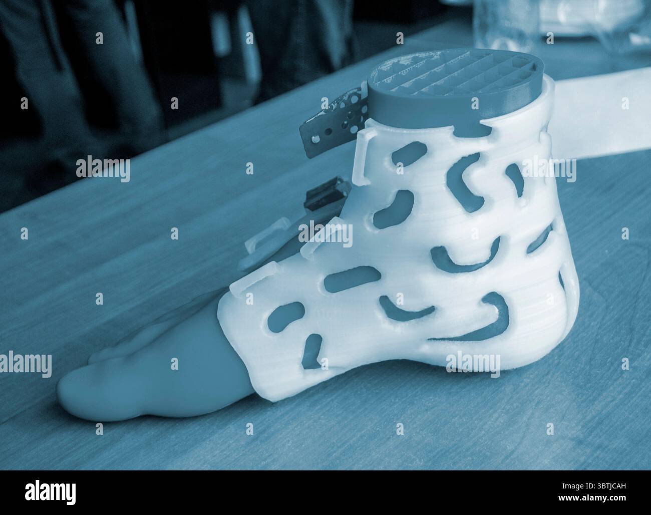 3d printed prosthesis hi-res stock photography and images - Alamy