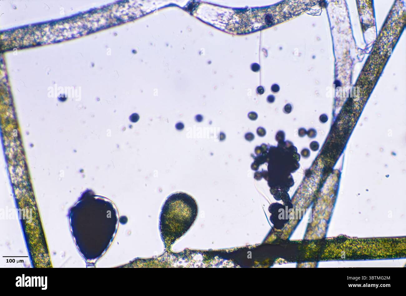Three sporangia have developed on the sporophyte of Derbesia sp ...