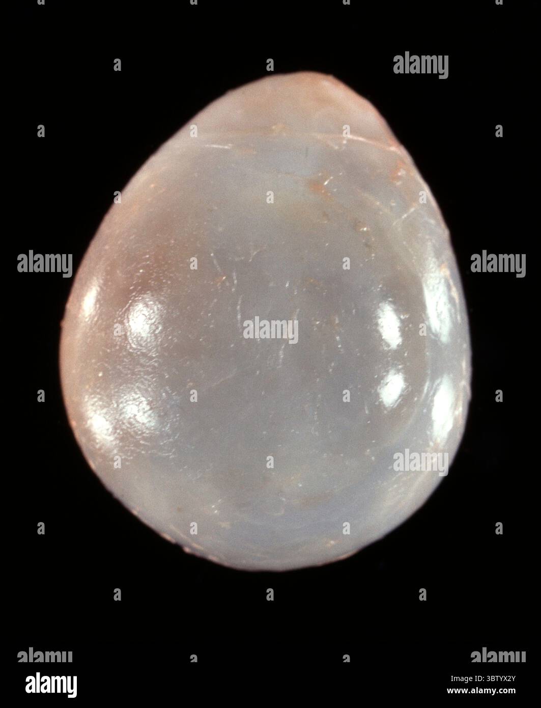 Hydatid cyst extracted from a human body. Hydatid cysts form around the ...