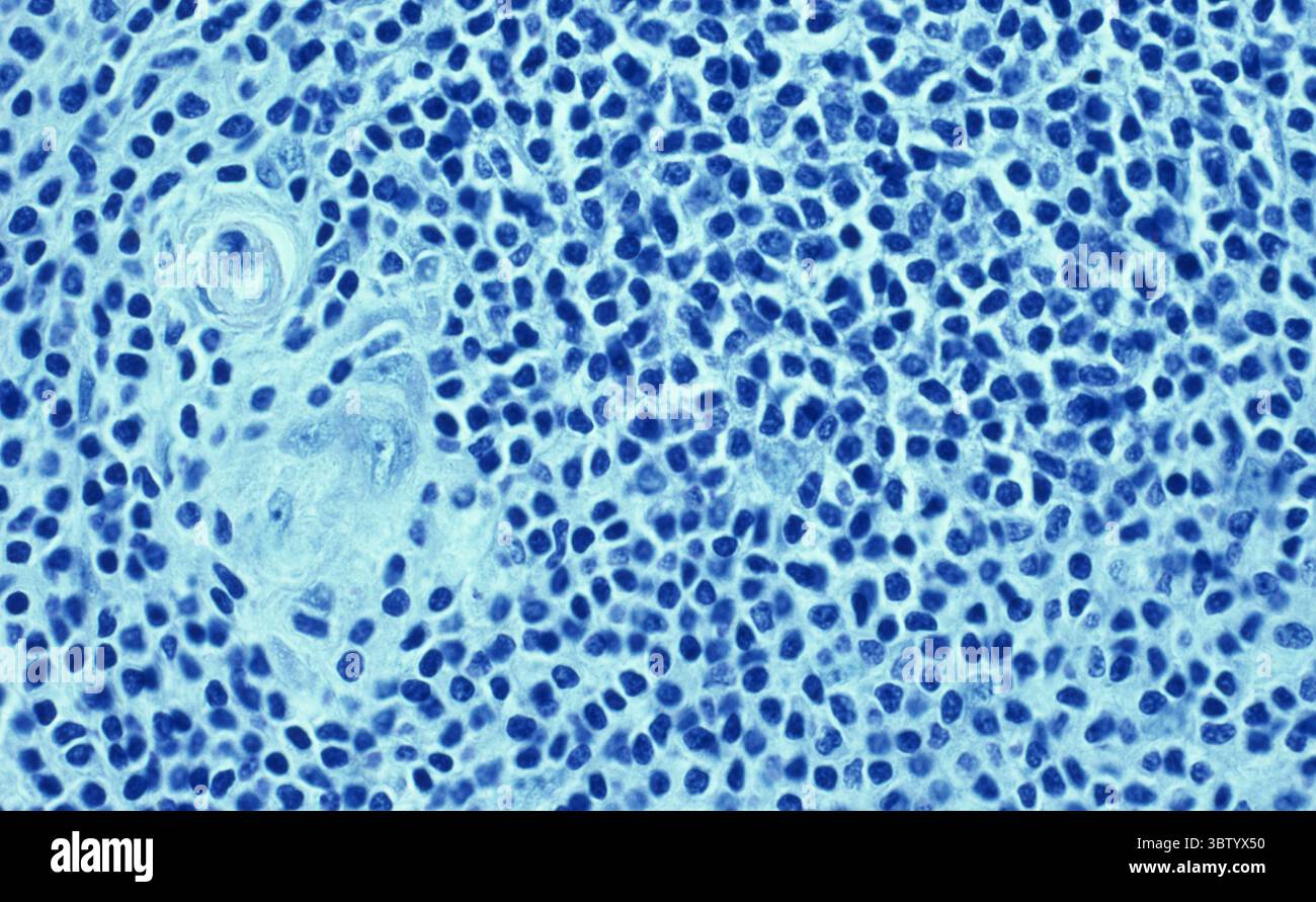 Light micrograph of a section through a cervical (neck) lymph node ...