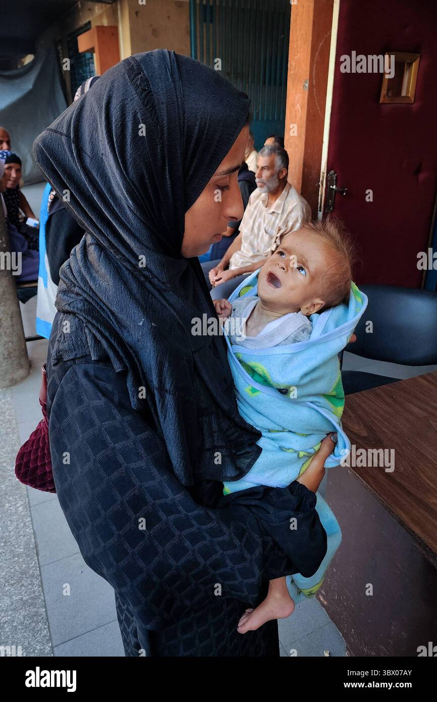 UNRWA health staff screen and treat children suffering from Severe ...