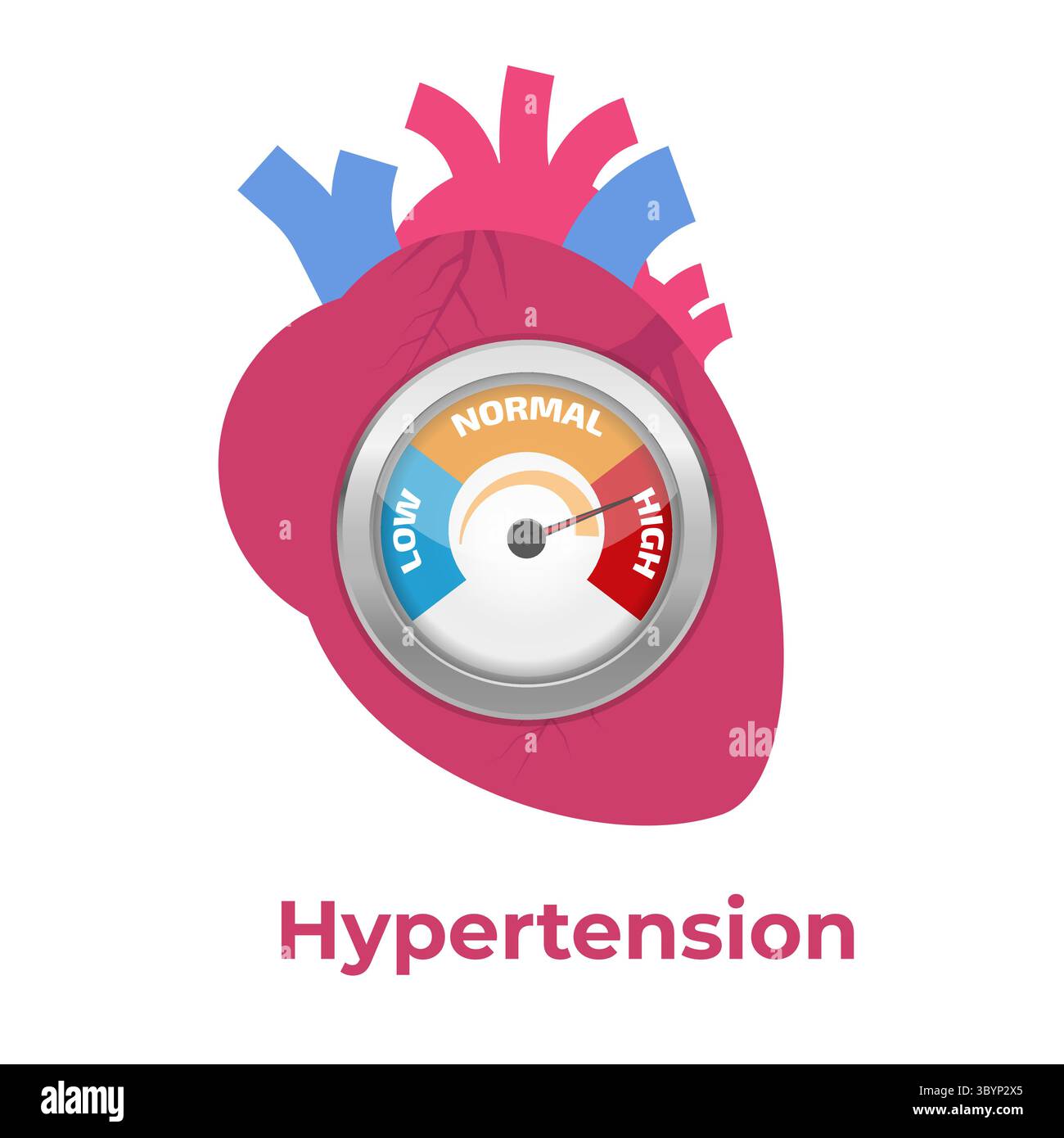 High blood pressure, hypertension concept. Vector illustration Stock ...