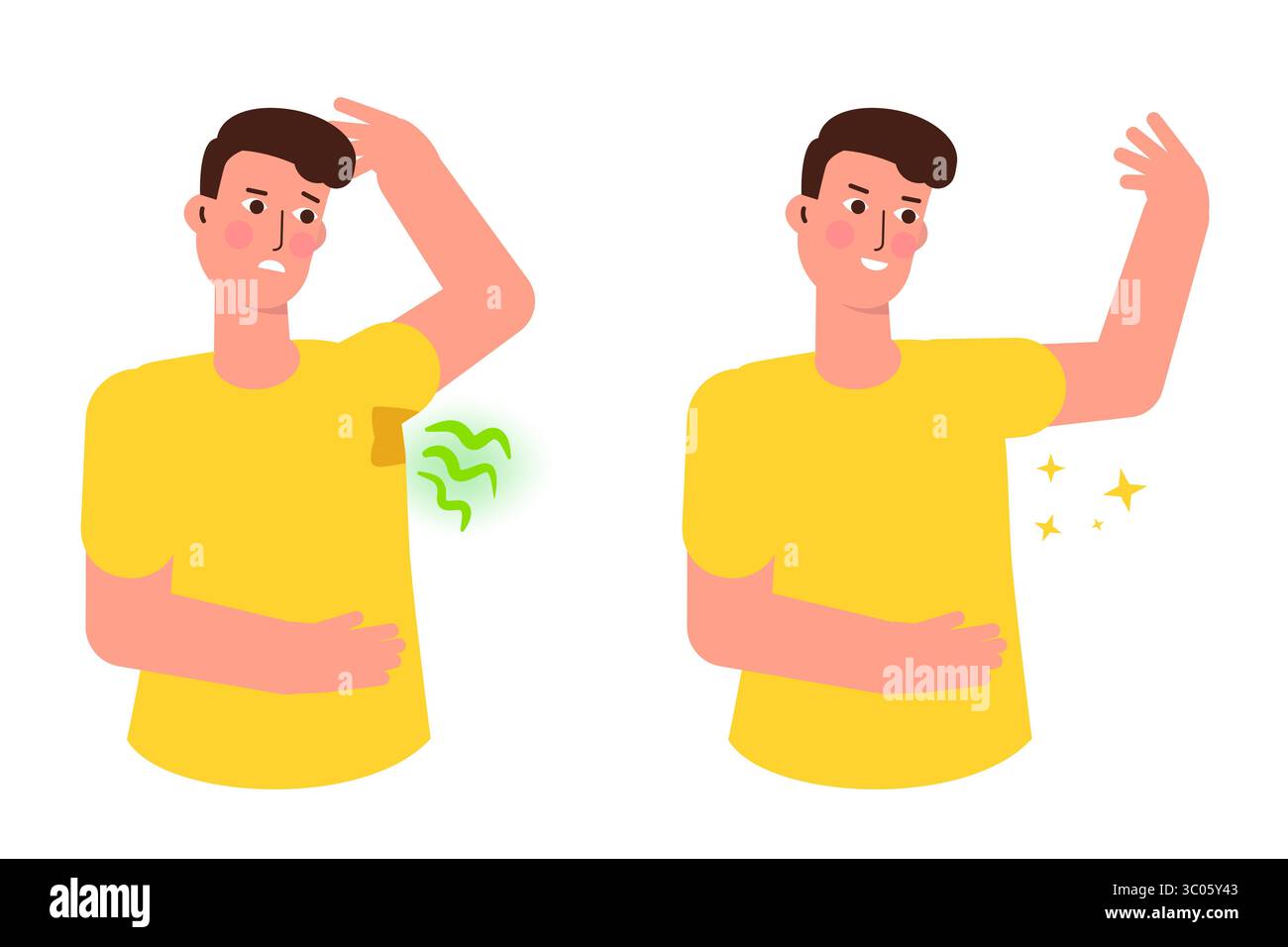 Sweaty armpits Hyperthyroidism sweating concept. Armpit problem and ...