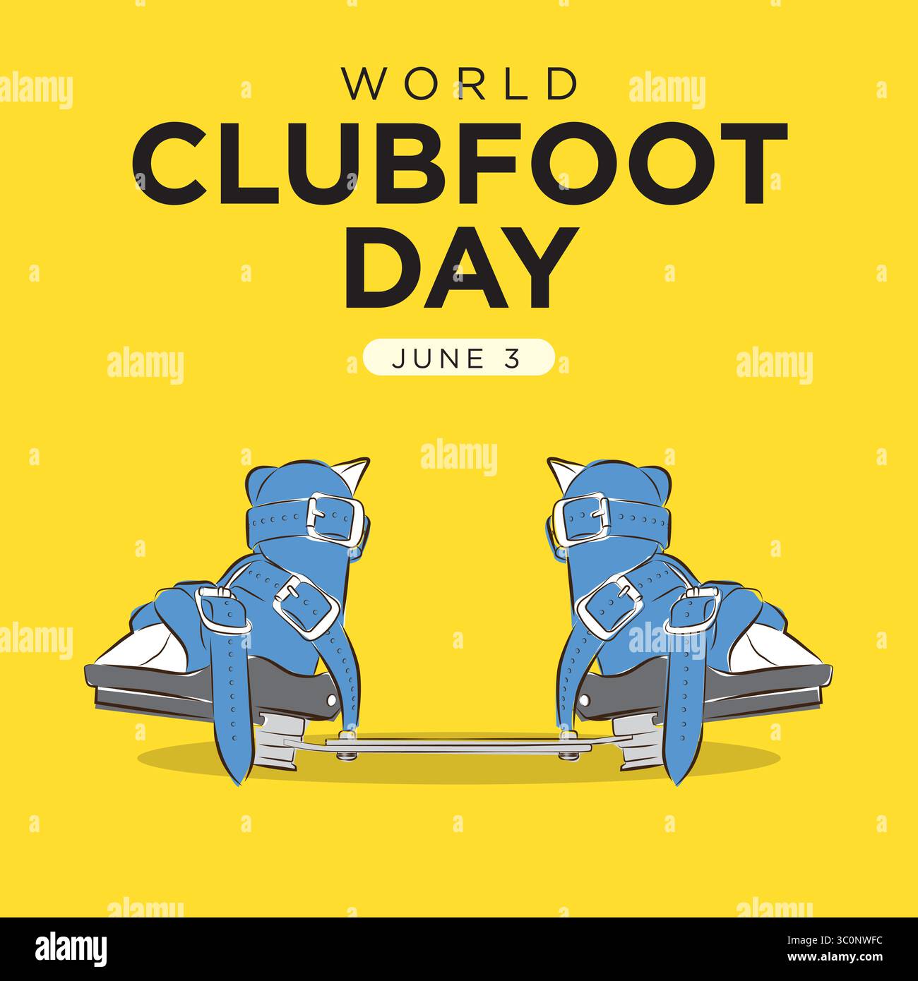 Clubfoot hi-res stock photography and images - Alamy