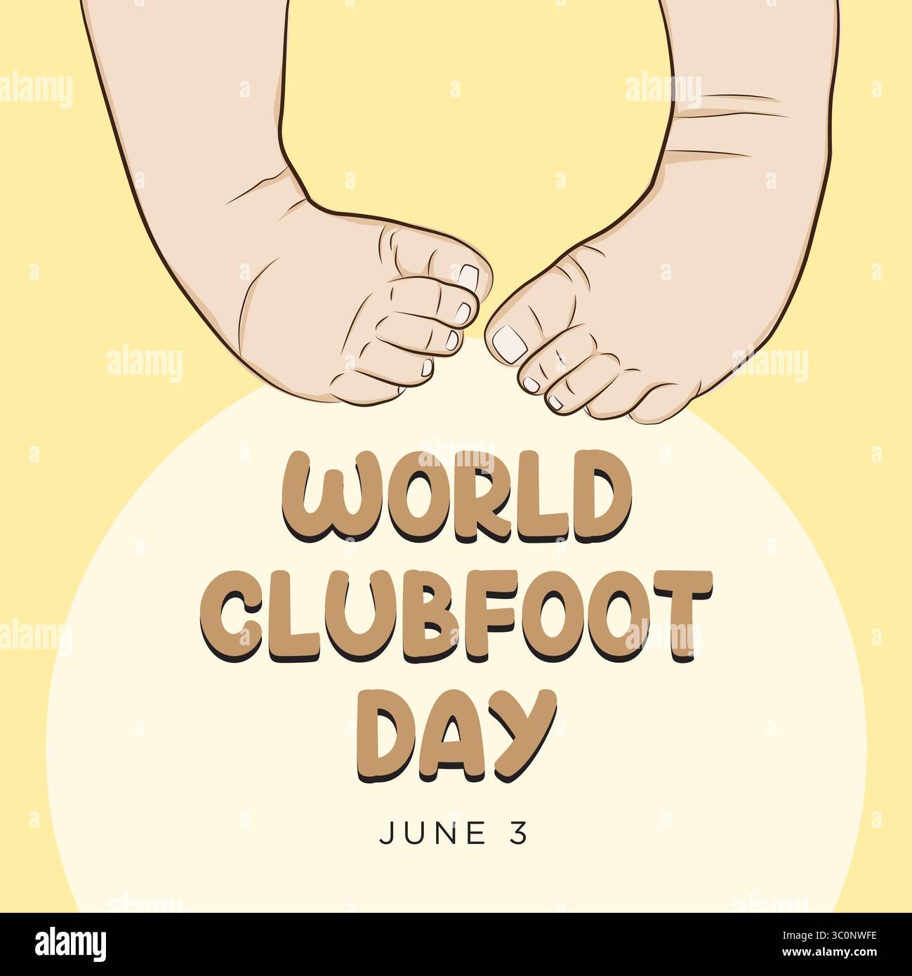 Vector illustration of World Clubfoot Day poster Stock Vector Image ...