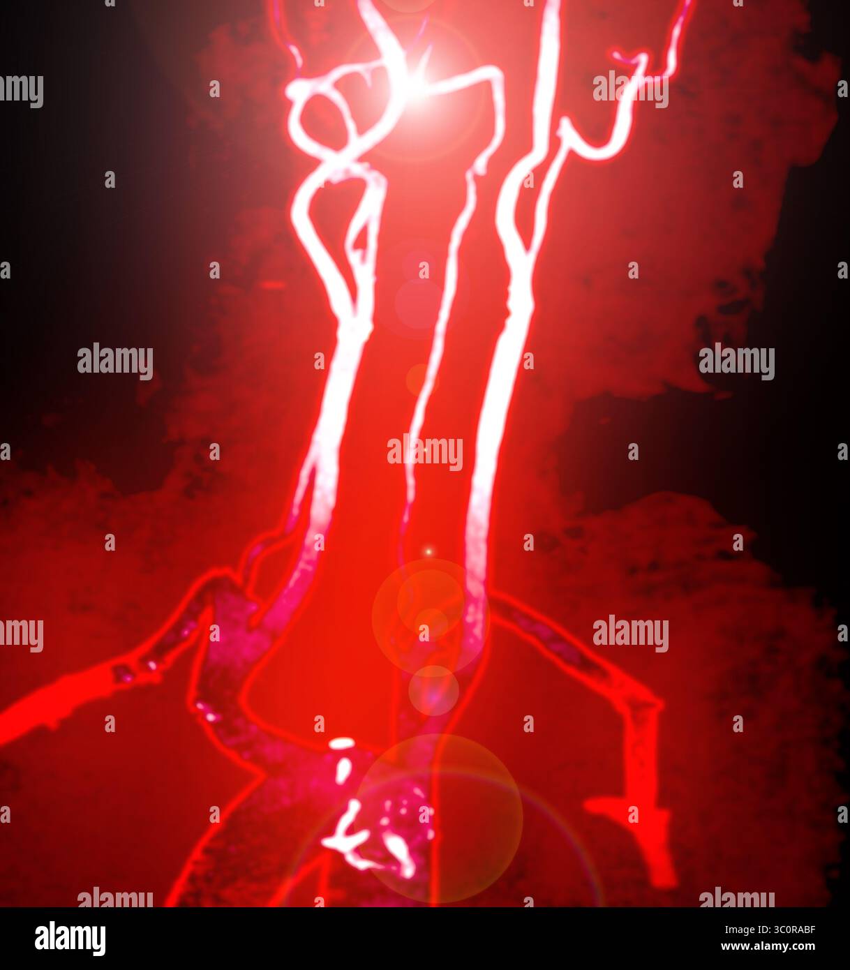 Vivid MRA scan reveals symmetrical flow of blood through the neck's ...