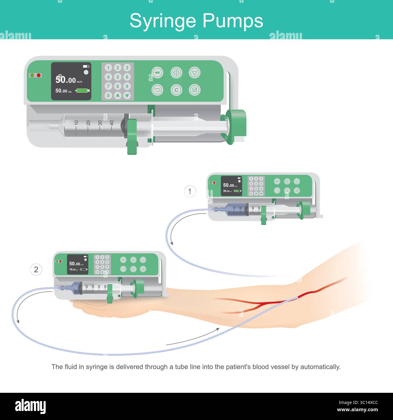 Intravenous infusion pump Stock Vector Images - Alamy