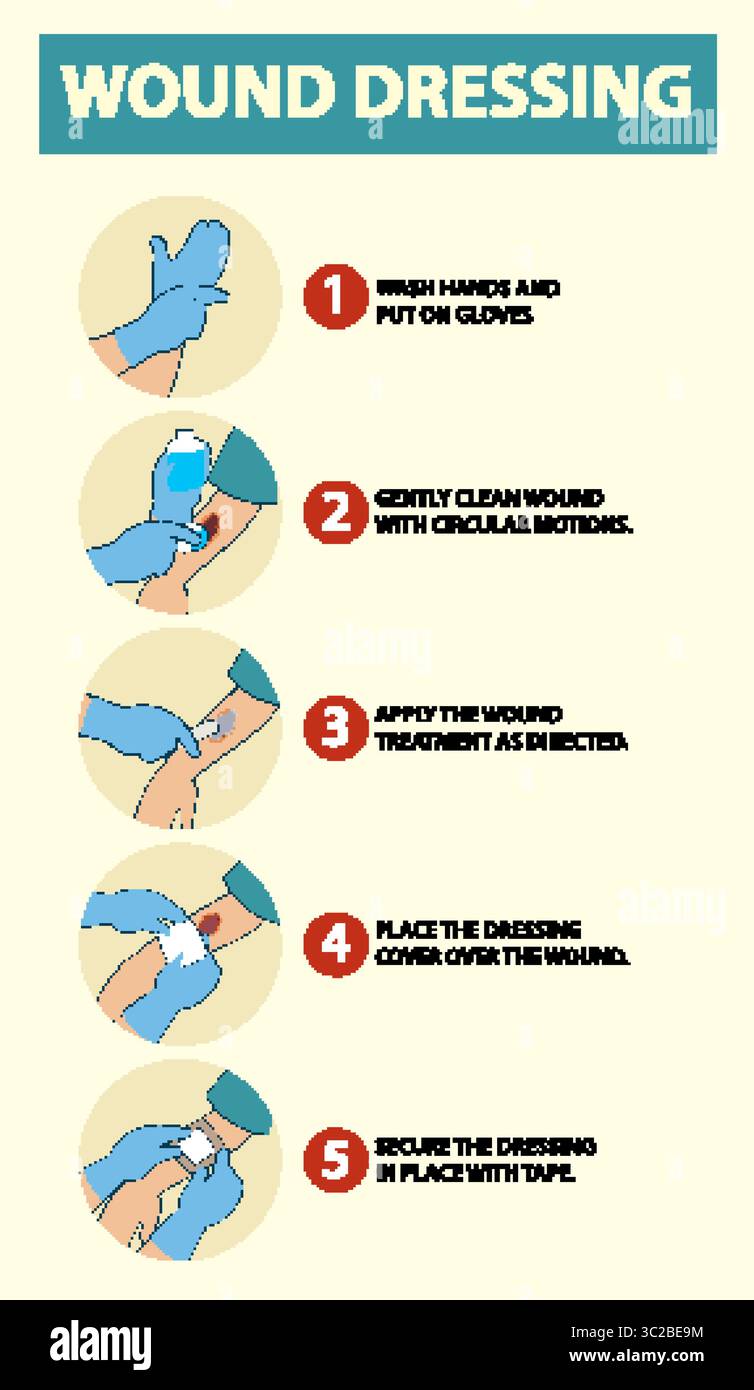 Illustration detailing five steps for proper wound dressing, featuring ...