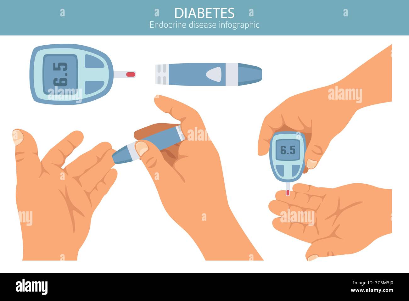 Diabetes. Endocrine diseases. Medical infographic design. Vector ...