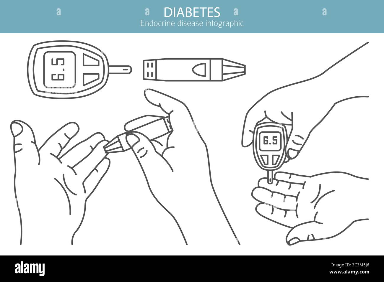 Diabetes. Endocrine diseases. Medical infographic design. Vector ...