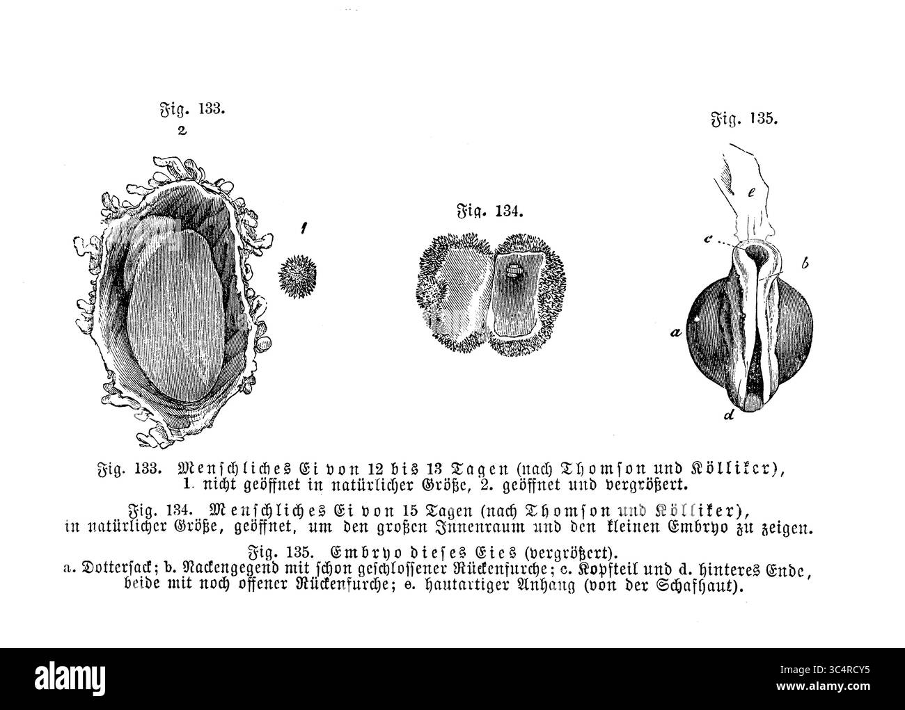 Embryology: human egg of 12-13 days, egg of 15 days opened with embryo ...