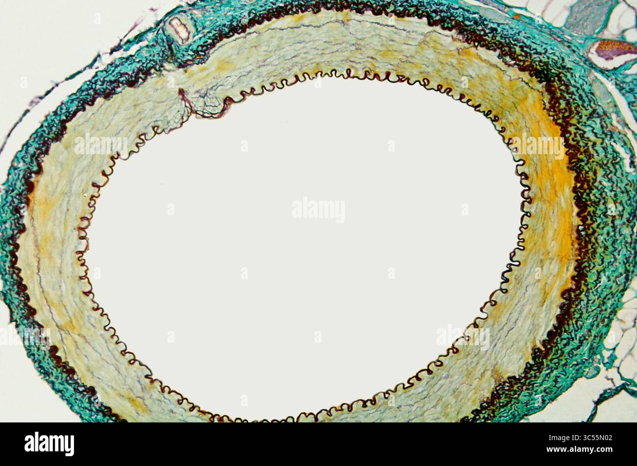 Light micrograph of the muscular artery wall stained with the orcein ...