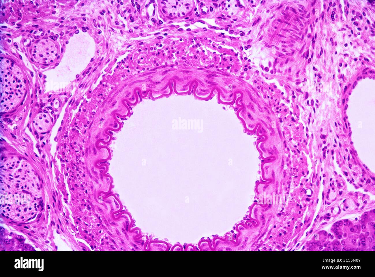 Light micrograph of a cross-sectioned muscular artery, showing from the ...