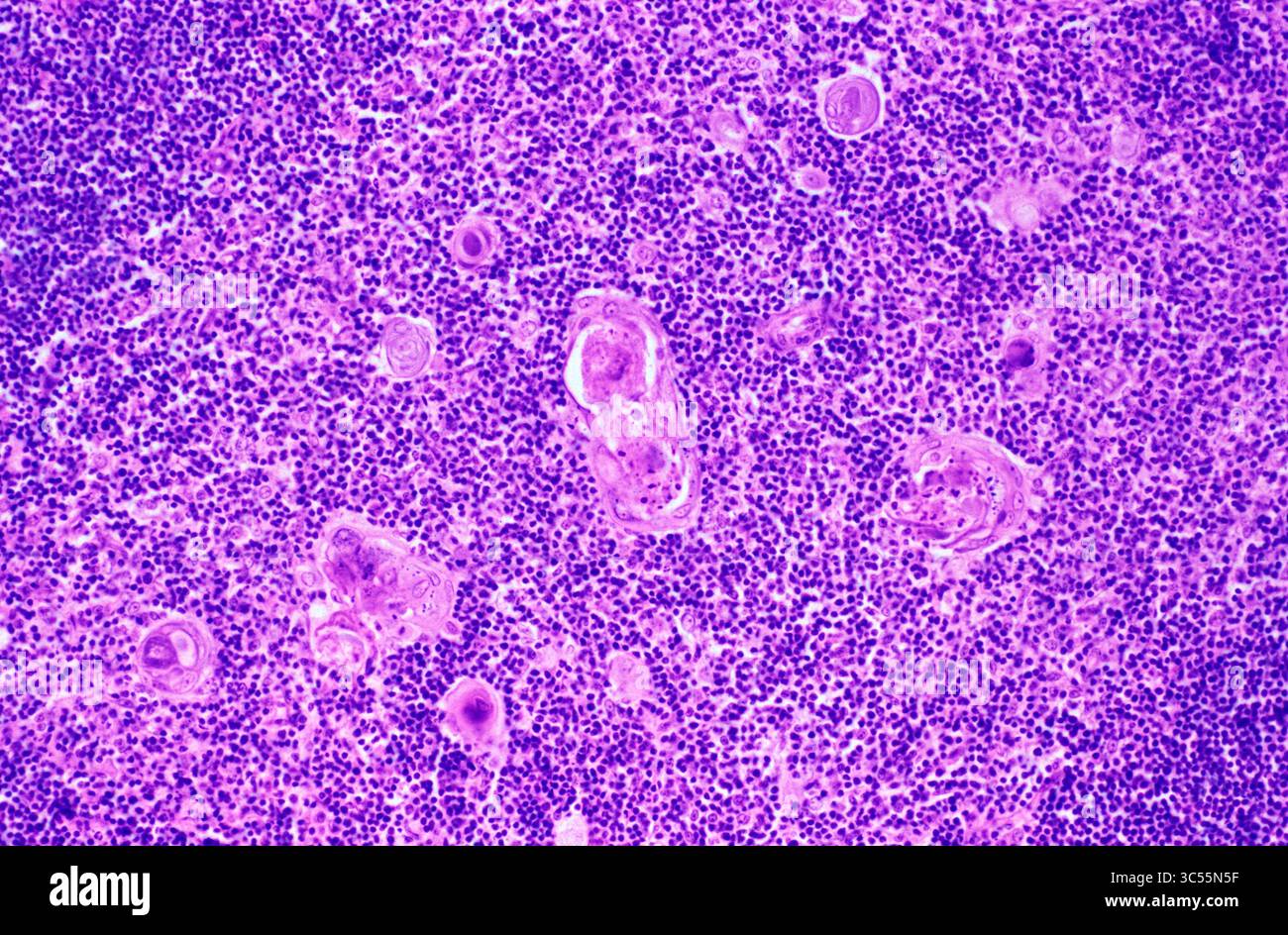 Light micrograph of a thymus medulla showing many Hassall's corpuscles ...