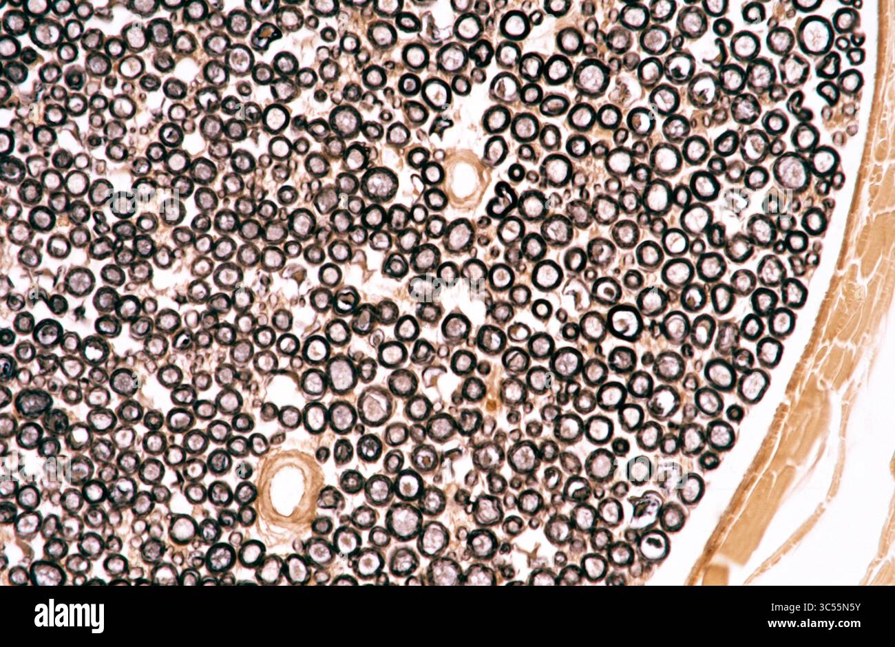 Light micrograph of a cross-sectioned myelinated nerve stained with ...