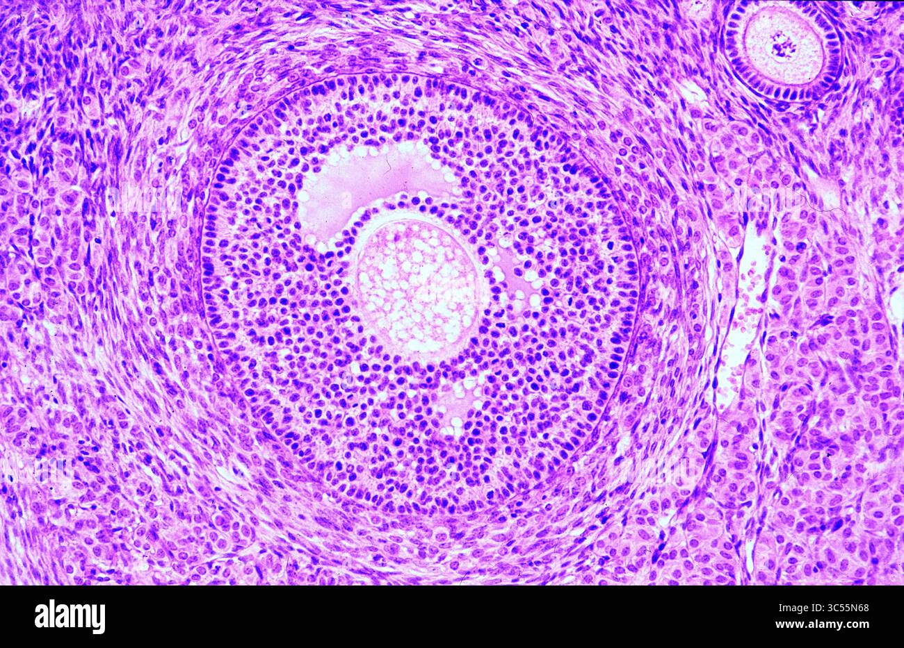 Light micrograph of a newly formed tertiary follicle with a clearly ...