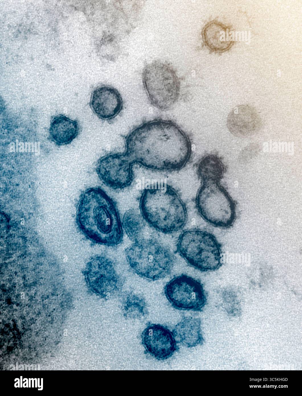 Transmission electron microscope color enhanced hi-res stock ...
