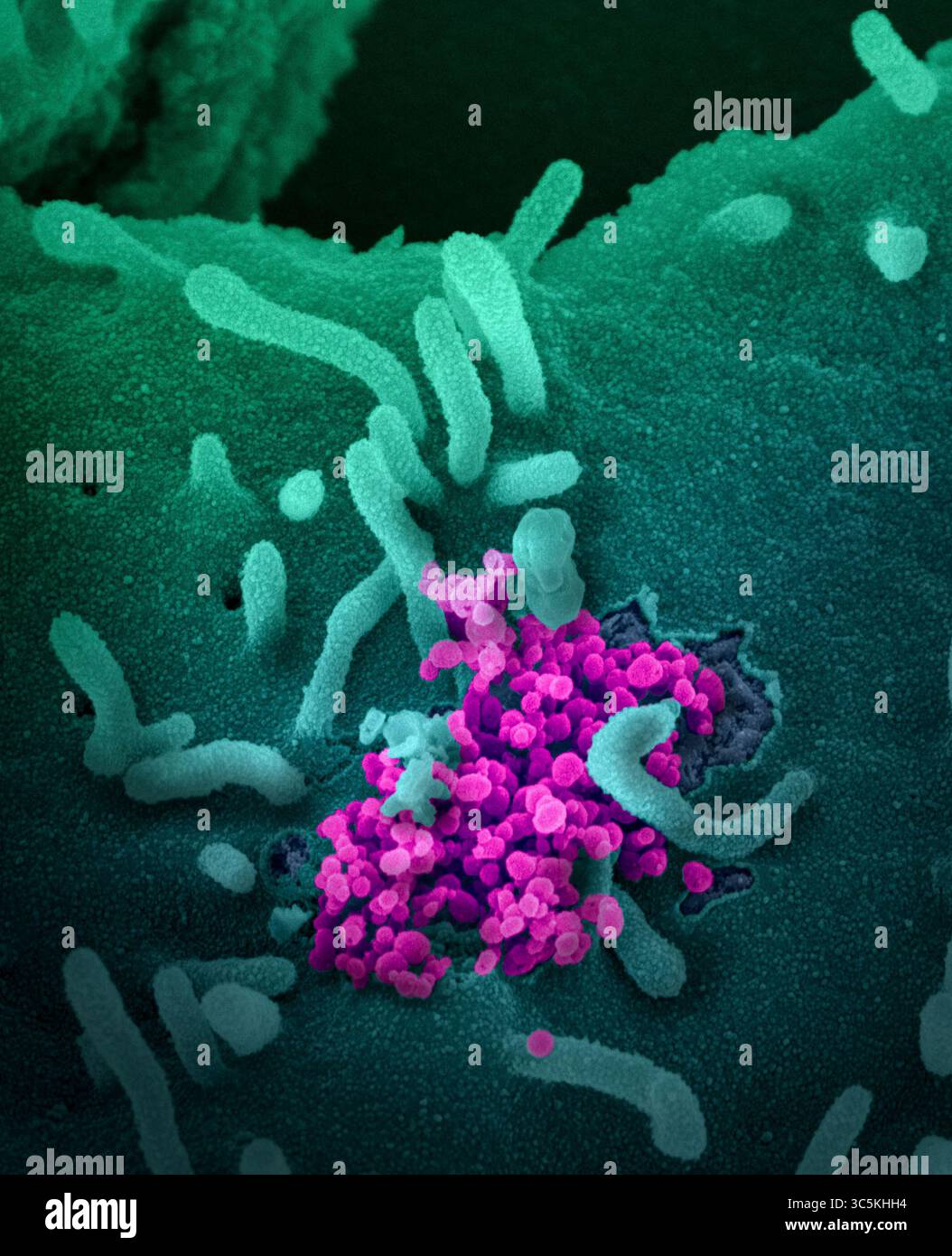 Transmission electron microscope color enhanced hi-res stock ...