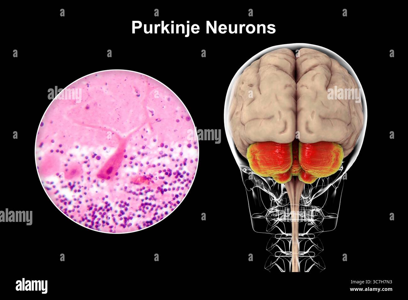 Purkinje Cells In The Cerebellum Hi Res Stock Photography And Images