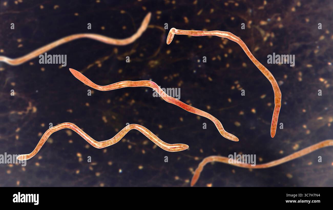 Illustration of Brachyspira pilosicoli bacteria. This spiral-shaped ...