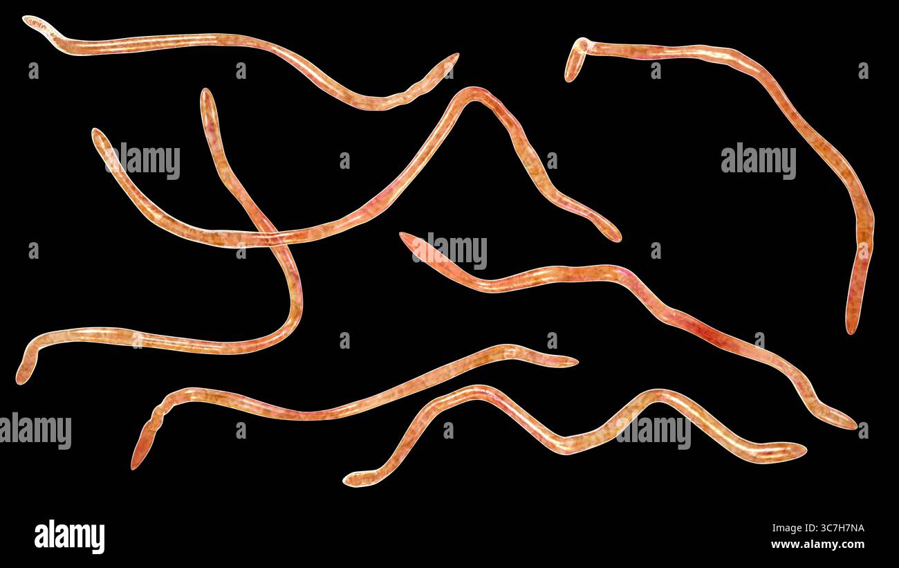 Illustration of Brachyspira pilosicoli bacteria. This spiral-shaped ...
